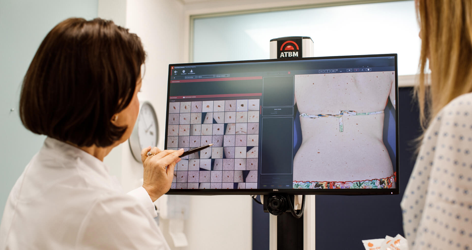 Mole Mapping - Advanced Dermatological Clinic